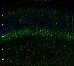 Cortical Layer Markers from Atlas Antibodies