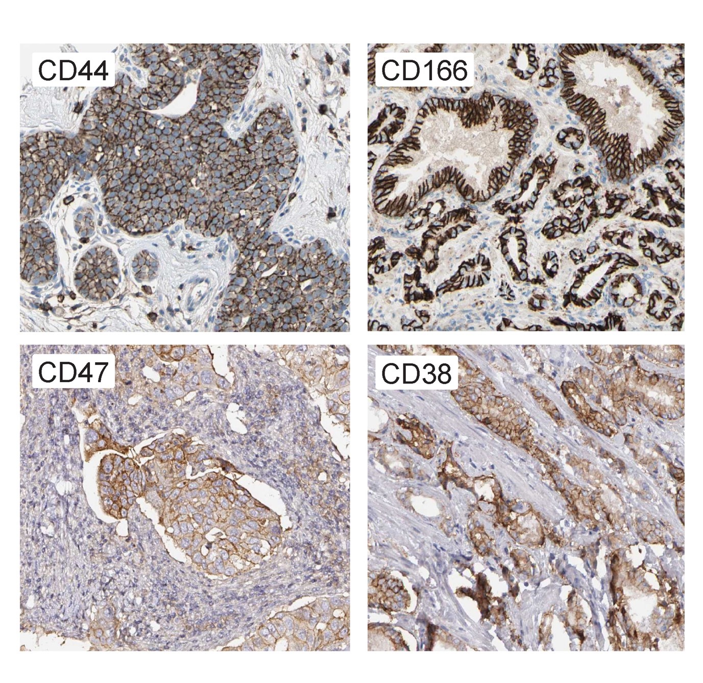 CD Markers: unlocking neurobiology and cancer insights